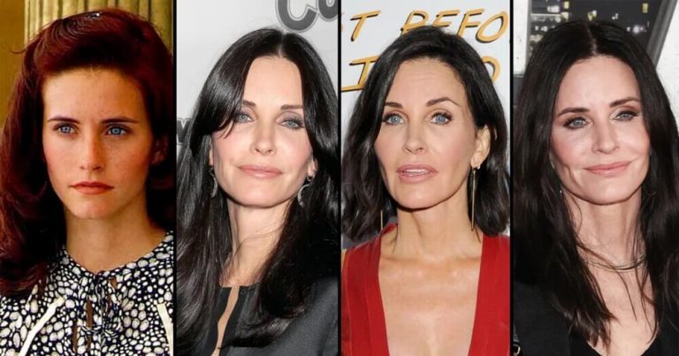Celebrities Who Had Plastic Surgery: We Examined 41 Stars - Zaren Health