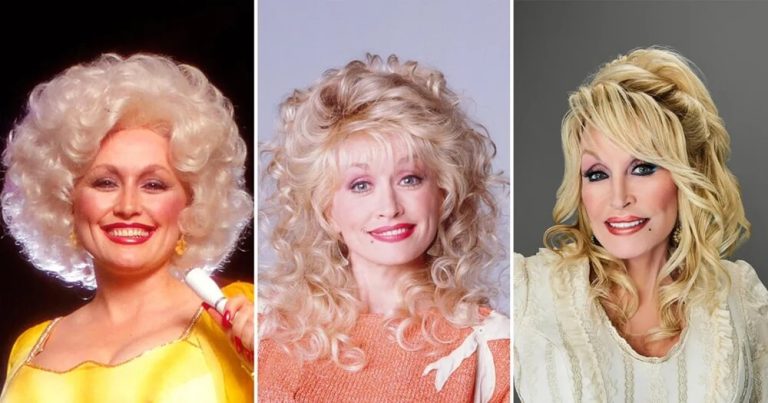 Celebrities Who Had Plastic Surgery: We Examined 41 Stars - Zaren Health