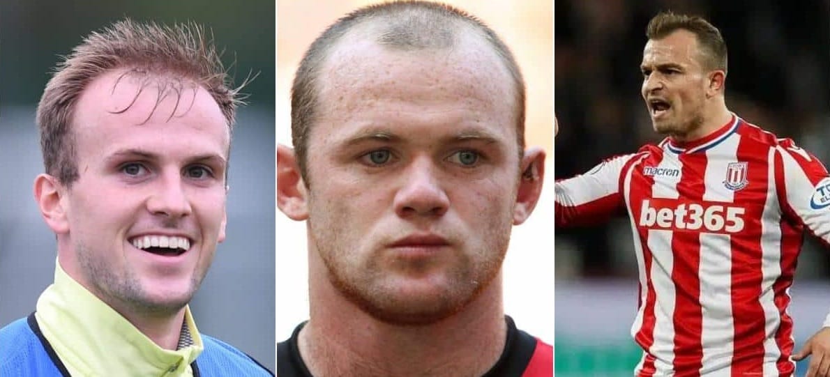 Famous Football Players Who Had Hair Transplants - Zaren Health