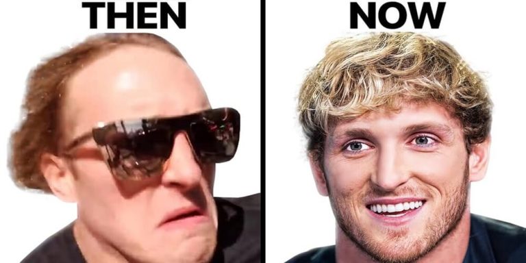 Logan Paul’s Hairline Glow-Up: Did he Get a Hair Transplant? - Zaren Health