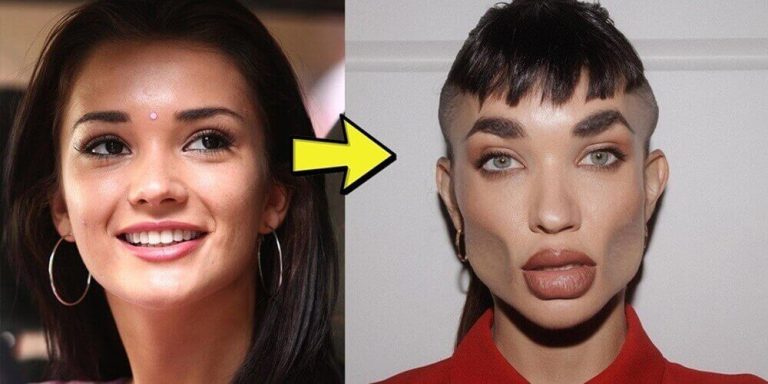 Amy Jackson’s Beauty Evolution: Plastic Surgery or Natural Glam? - Zaren Health