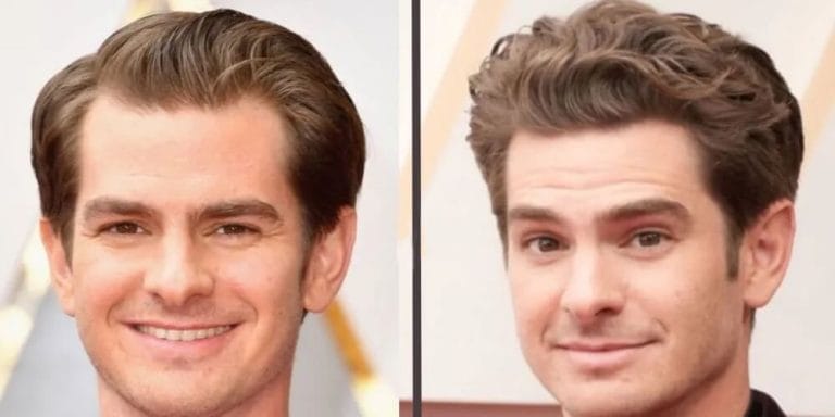 Did Andrew Garfield Get a Hair Transplant? Facts and Things to Know ...