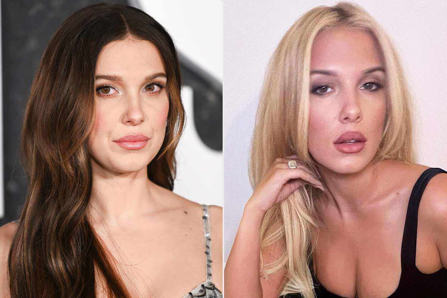 Le secret de la chirurgie plastique de Millie Bobby Brown - Zaren Health