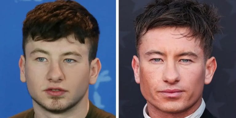 Barry Keoghan Aesthetic Before and After: What’s Behind the Actor’s New ...
