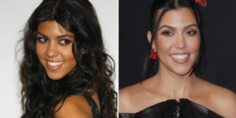 Kourtney Kardashian’s Balanced Approach to Beauty: From Botox to a ...