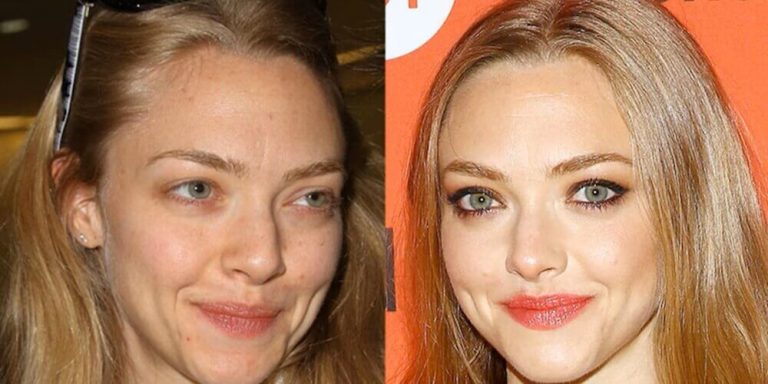 Amanda Seyfried Beauty Secrets: Plastic Surgery, Botox, Breast Implants ...